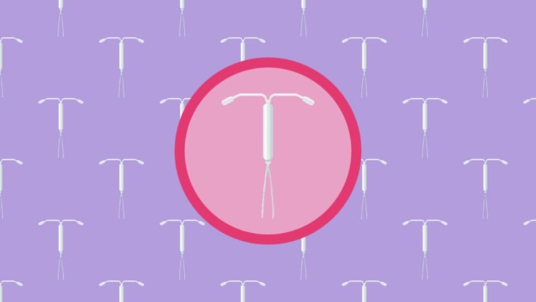 Copper Iud Pros And Cons