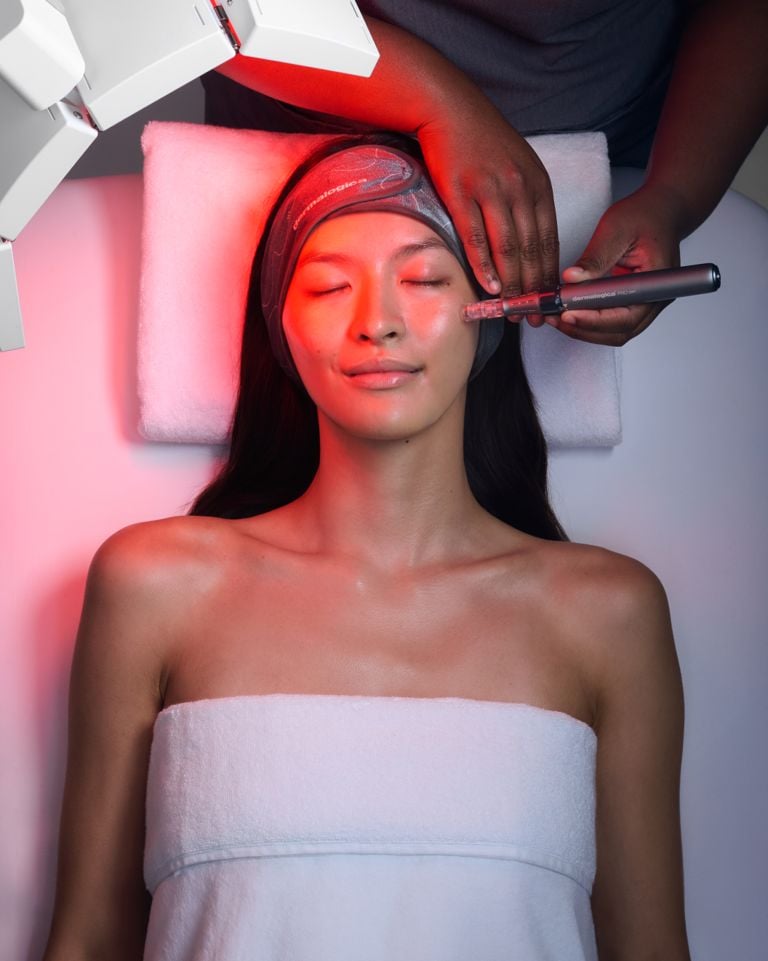 The New Age of Chemical Peels - FASHION Magazine